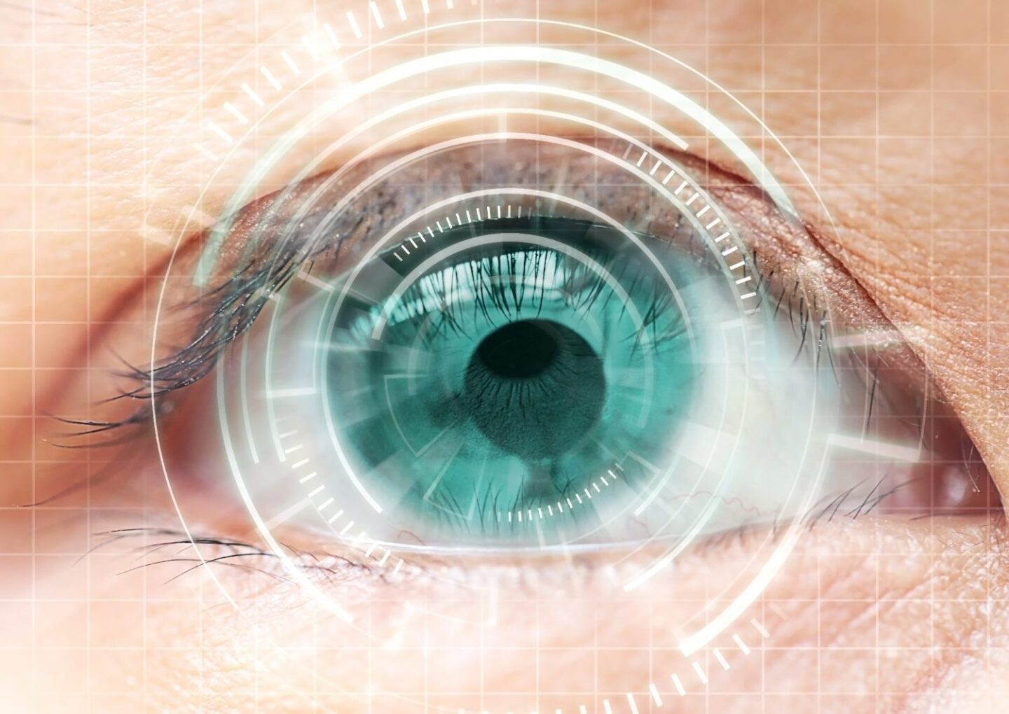How Does Bladeless LASIK Work? - TLC Laser Eye Centers